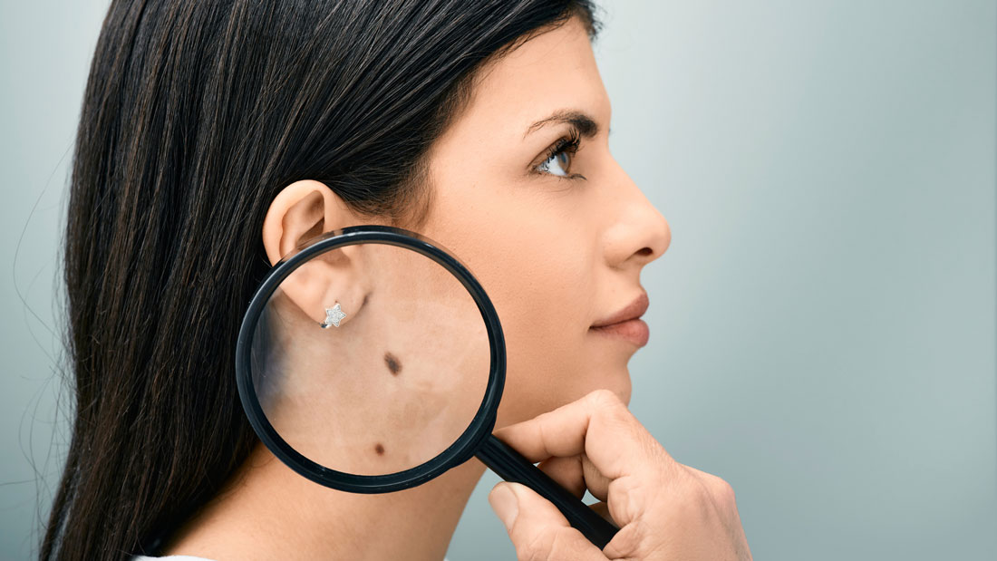 Got skin cancer questions? Here's what you need to know - Gulf Coast ...